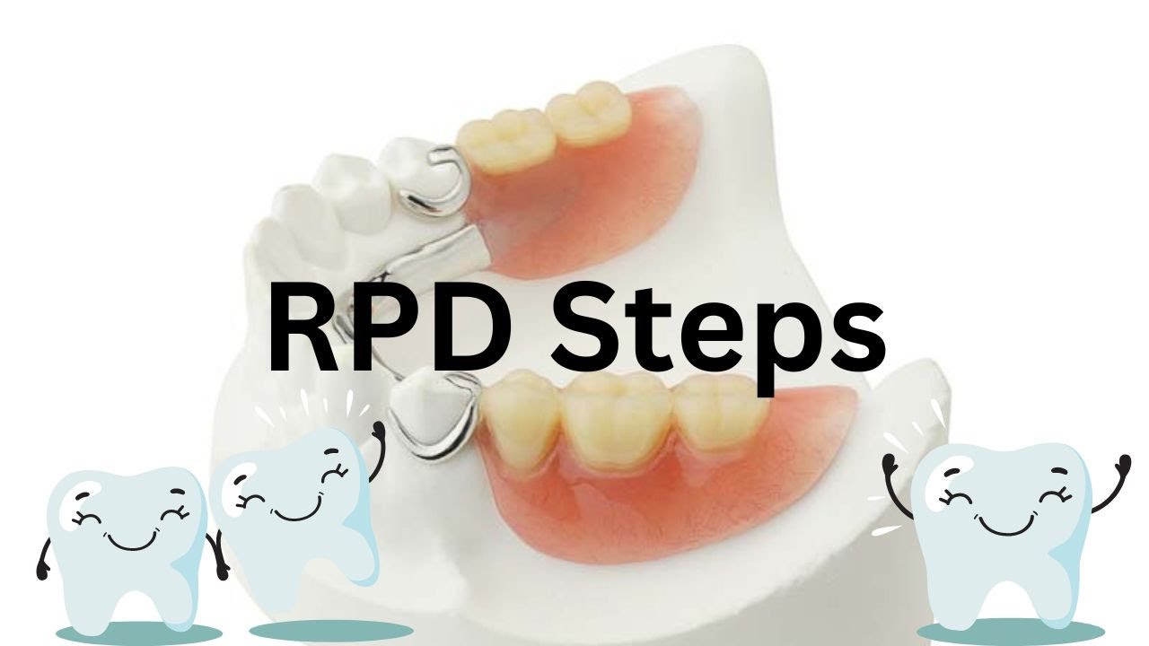 RPD Step By Step Procedure SIMPLIFIED YouTube rpd-step-by-step-procedure-simplified-youtube