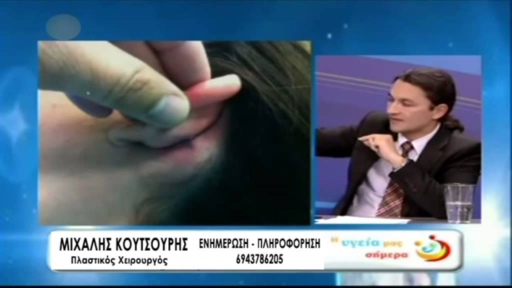 Μιχάλης Κουτσούρης: Ωτοπλαστική - YouTube