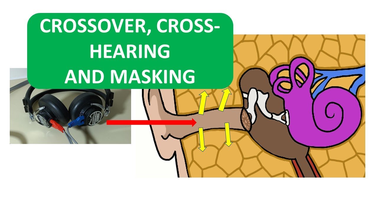 4A Crossover Cross Hearing and the Need for Masking - YouTube