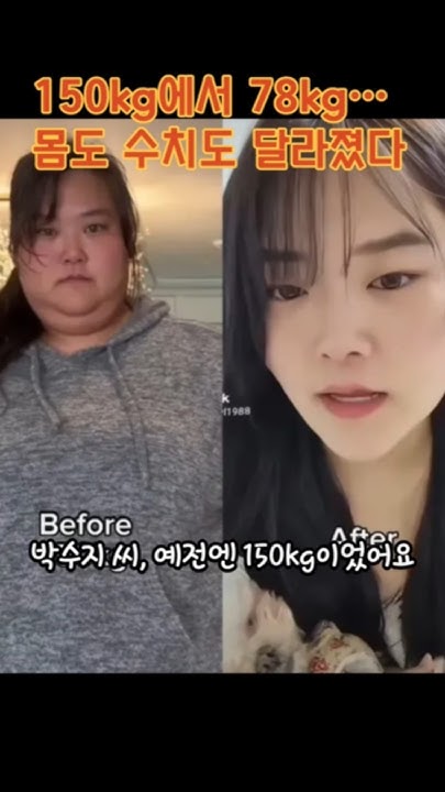 150kg에서 78kg몸도 수치도 달라졌다#72kg감량성공 #박수지다이어트 #혈당정상 #당뇨관해 #비만의위험 #다이어트 #필미커플 #혈당관리 #체중감량꿀팁 #당화혈색소정상화 ...