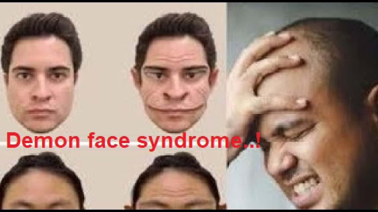 Demon face syndrome..! #demonfaces #mystery #mystery #views #usa # ...