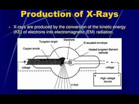 Understanding X-Rays |Generation & Types of X-Rays| - YouTube