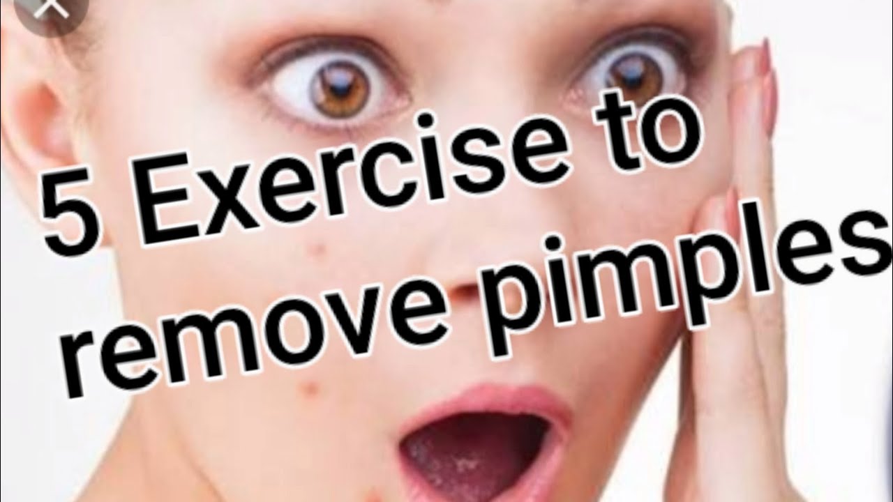 100 % pimple removel exercises fast and easy - YouTube