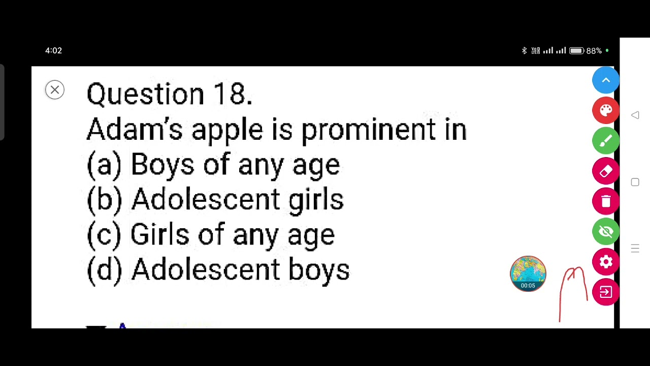 Adam's apple is prominent in :- (a) Boys of any age (b) Adolescent ...