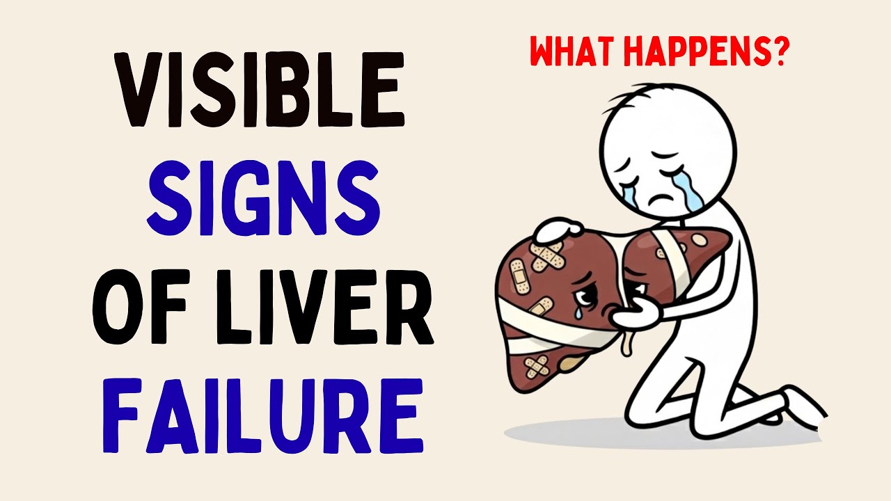 What Happens to Your Body When Your Liver Is Failing? 12 Visible Signs ...