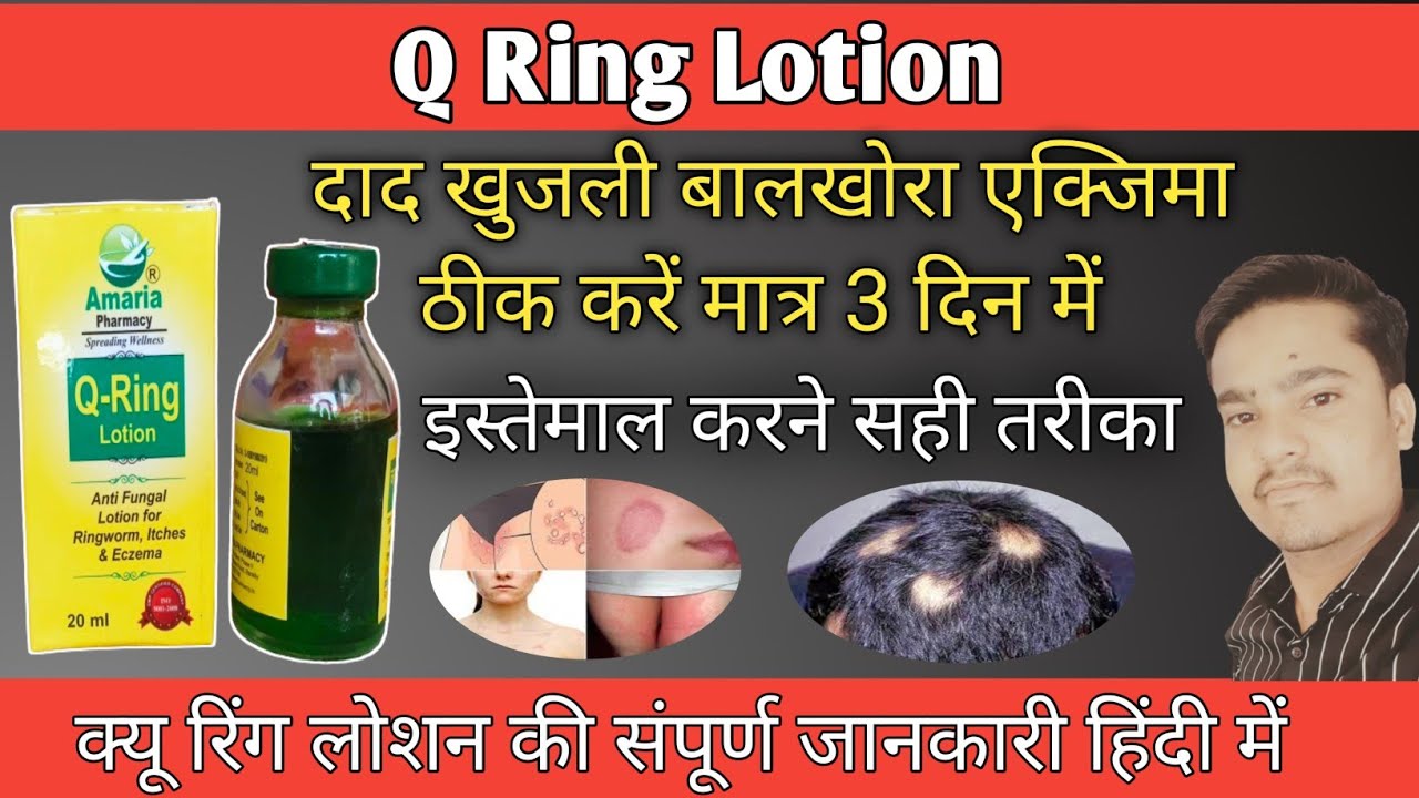 Q Ring Lotion | q ring lotion uses | q ring lotion uses in hindi | # ...