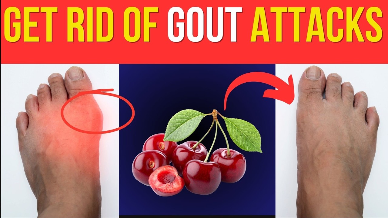 Effectively Detoxify Uric Acid and FIGHT GOUT – Uric Acid SOLUTION Diet ...