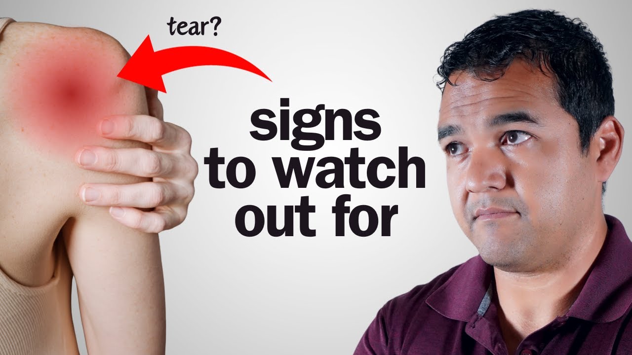 Rotator Cuff Tear Warning Signs to Watch Out For - YouTube