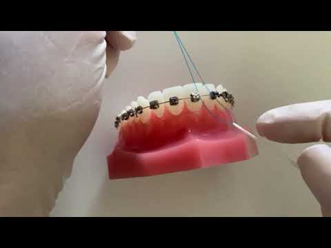 How to use a Floss Threader - YouTube