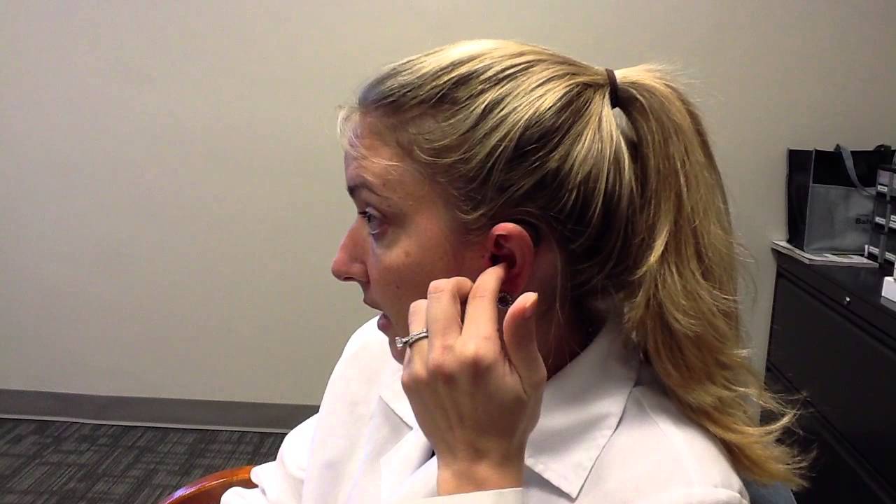 How to Insert a BTE HA - YouTube