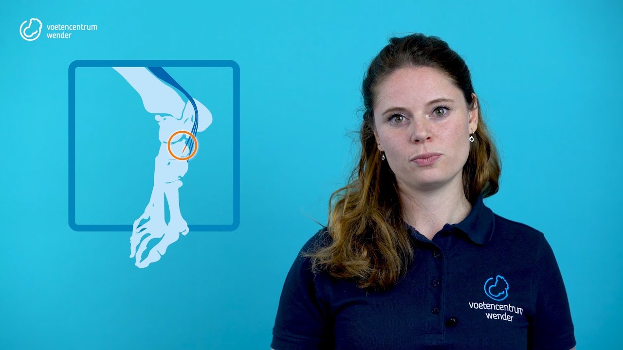 Overbelasting Achterste Scheenbeenspier - YouTube