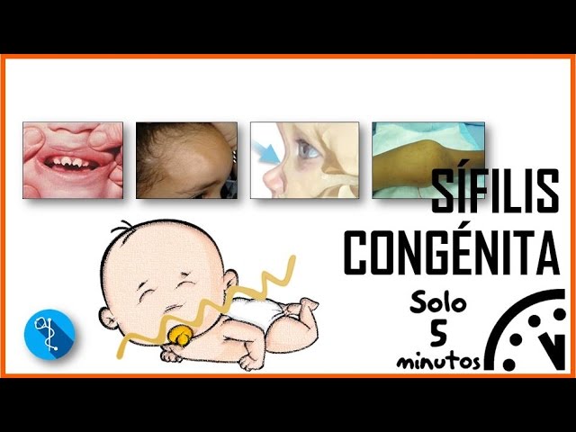 Diagrama De Sífilis Congénita