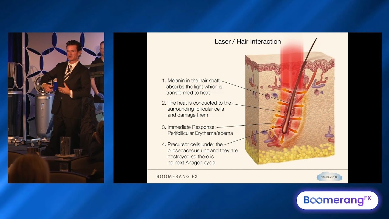 DioLaze by InMode: Mastering Laser Hair Removal - YouTube