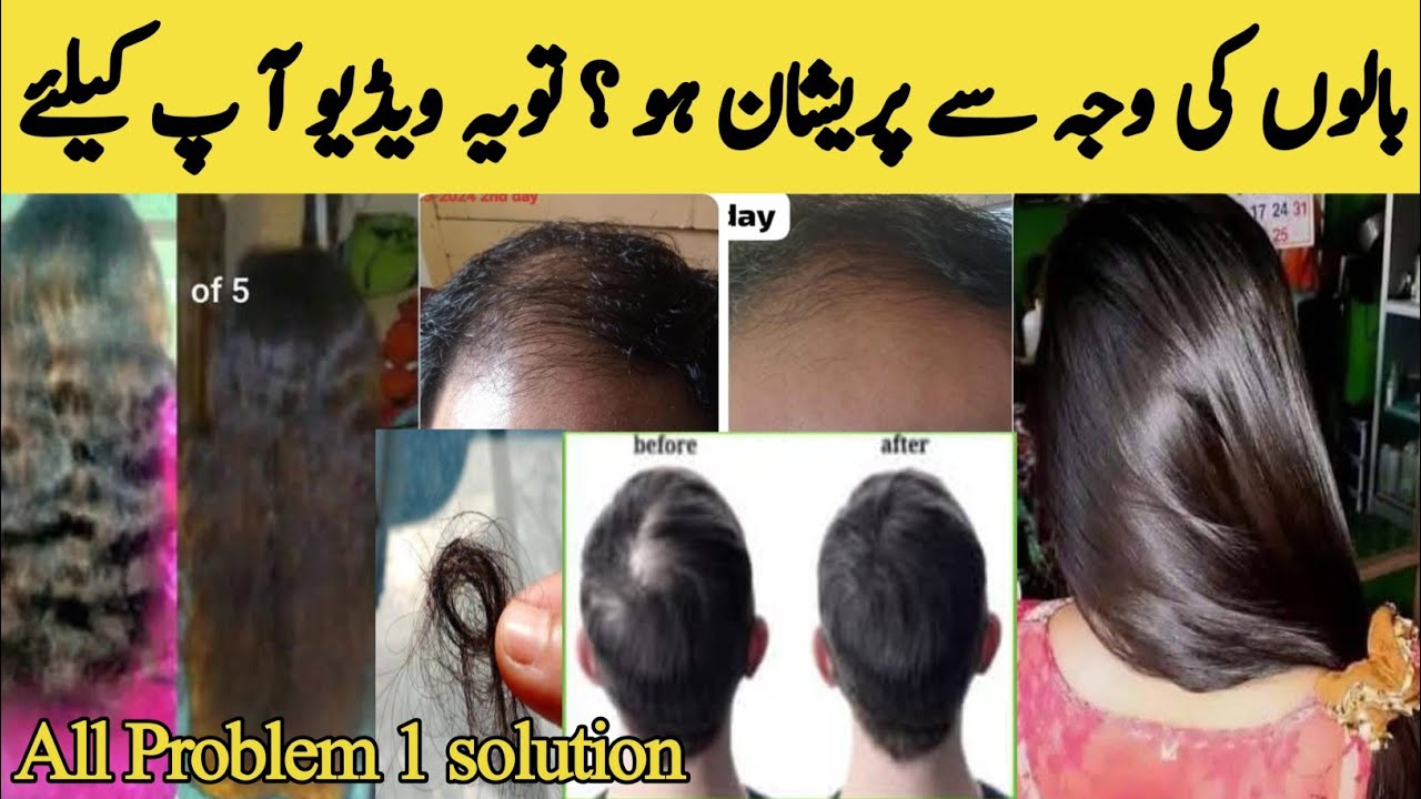 100% Natural Hair Smooth & Silky & shiny| All Hair Problem 1 solution ...