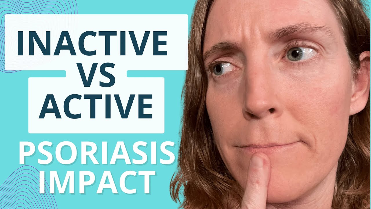 Inactive vs. Active: Why Exercise is Essential for Psoriasis Impact ...