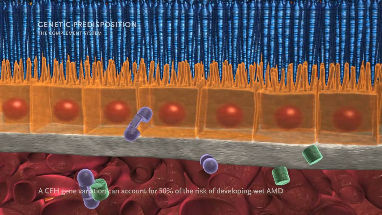 The Pathophysiology of Wet AMD - Degeneración macular humeda - YouTube