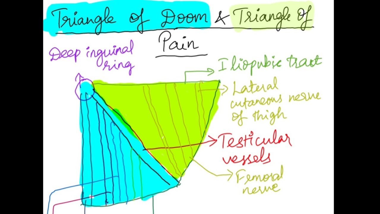 Topic - Triangle of Doom and Triangle of Pain #mbbs #hernias #neetpg # ...
