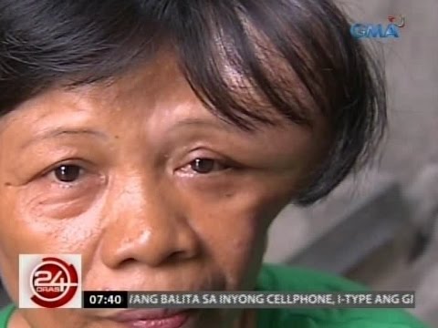 24 Oras: Ginang, pitong taon nang pinahihirapan ng bukol niya sa noo ...