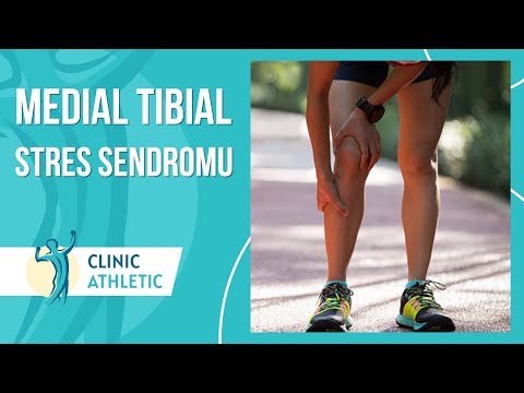 Medial Tibial Stres Sendromu Nedir? | Clinic Athletic
