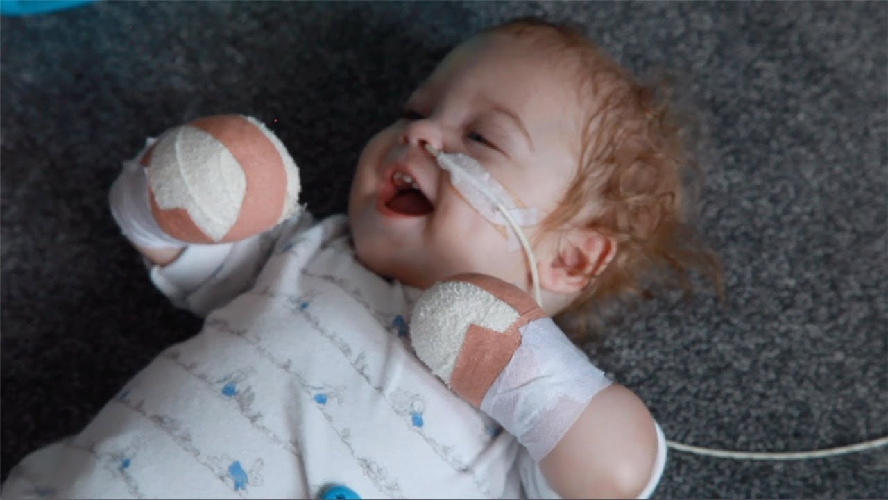 Baby Loses Limbs After Developing Sepsis - YouTube