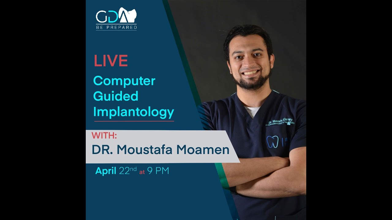 Computer guided implantology | Dr Mostafa Moamen - YouTube
