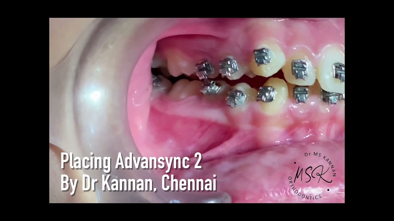 Advansync Sync- A wonder Appliance - YouTube