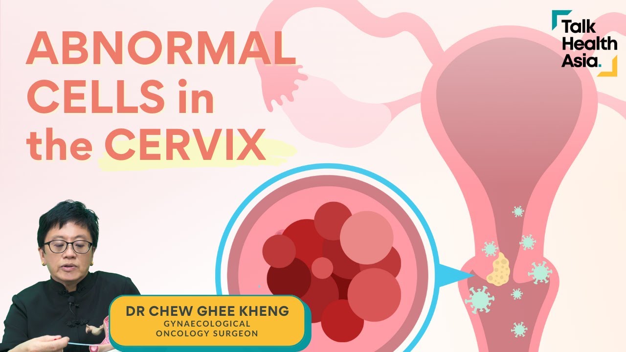 Abnormal Cells in Your Cervix - 6 Must-Knows | Dr Chew Ghee Kheng - YouTube