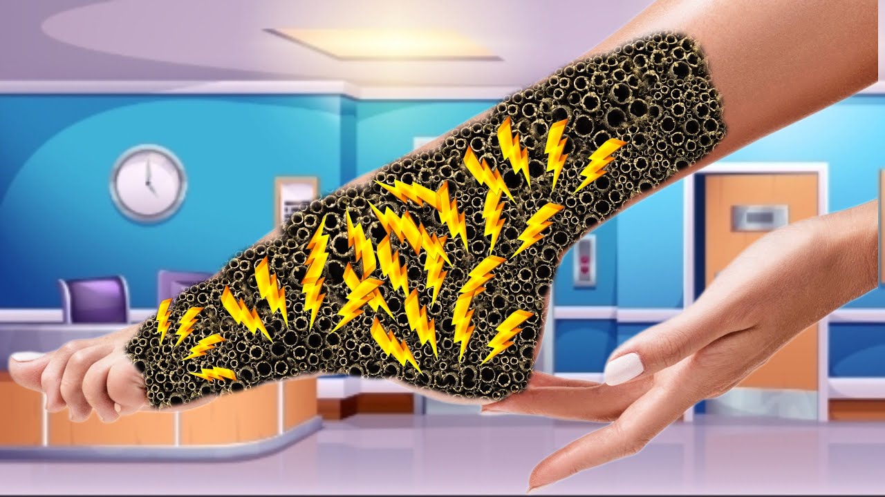 Asmr severely affected leg 🦵 animation | 2D Animation Leg surgery # ...