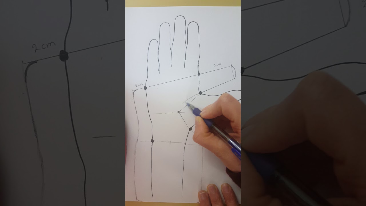 3 Finishing of cock up splint draw pattern - YouTube