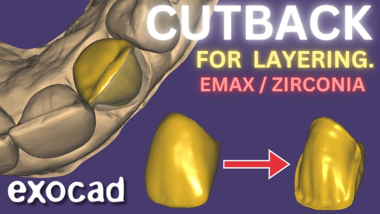 CUTBACK Crown Beginner 2024 Tutorial - YouTube