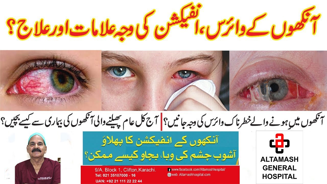 Prof .Dr. Syed Asif Ali ||PATIENT SUCCESS STROY Appreciating The Best ...