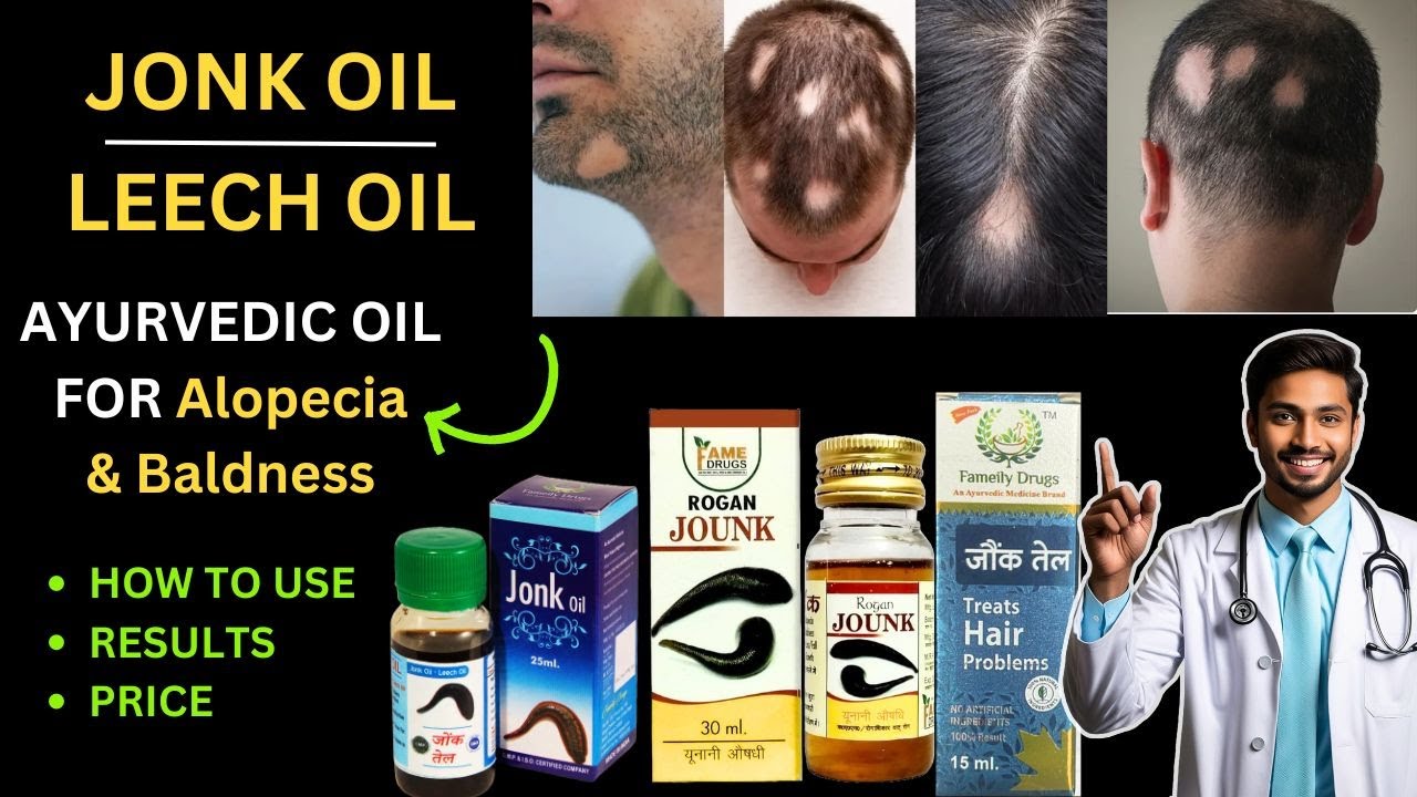 LEECH OIL | JONK OIL | FOR ALOPECIA | JONK KA TEL | HOW TO USE | REVIEW ...