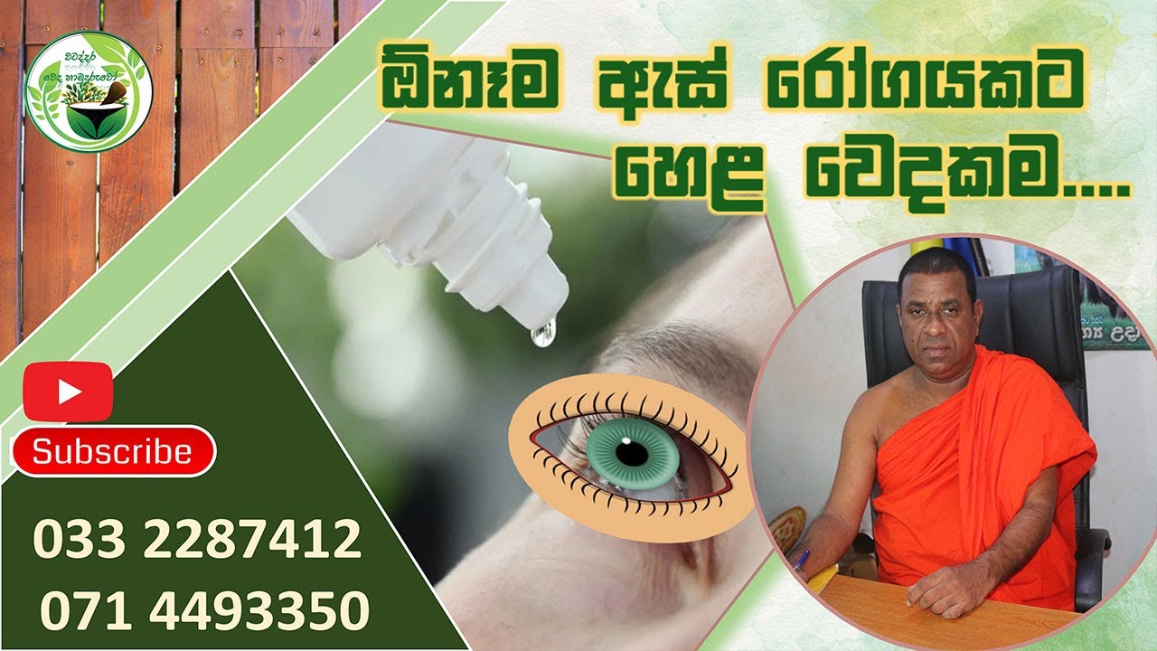 wataddara as wedakama| වටද්දර ඇස් වෙදකම| Glaucoma: Causes, |Symptoms ...