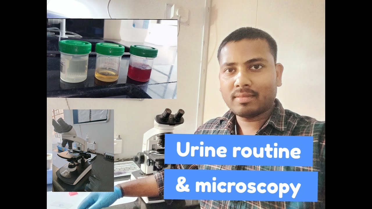 Urine Routine Microscopy Practical With Theory How To Test Urine urine-routine-microscopy-practical-with-theory-how-to-test-urine