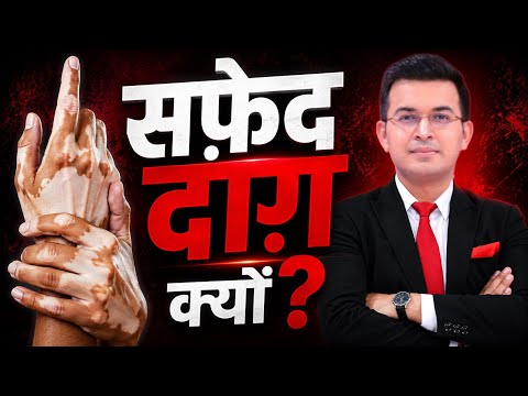 Vitiligo Explained: Why White Patches Appear on Skin !  Healthbook | Shubhankar Mishra |