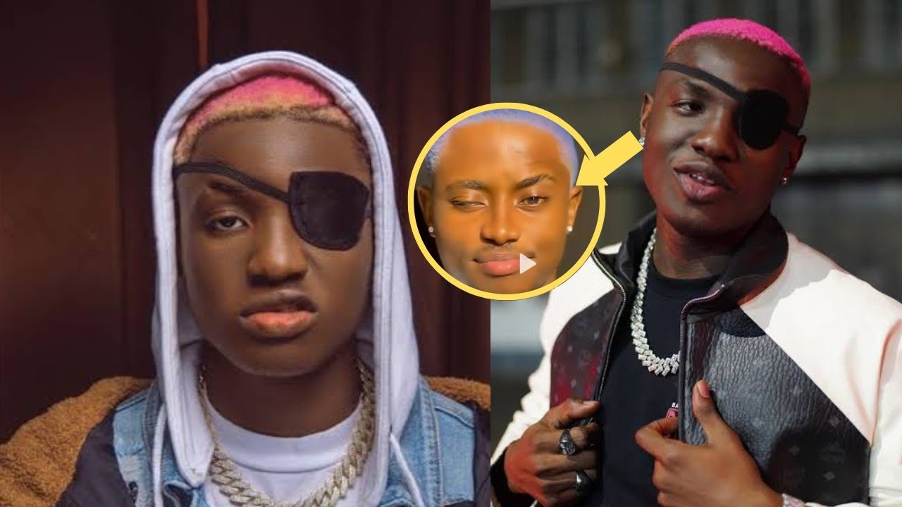 Ruger Real Face And Eyes Expósed To Fans At Last😱 - YouTube