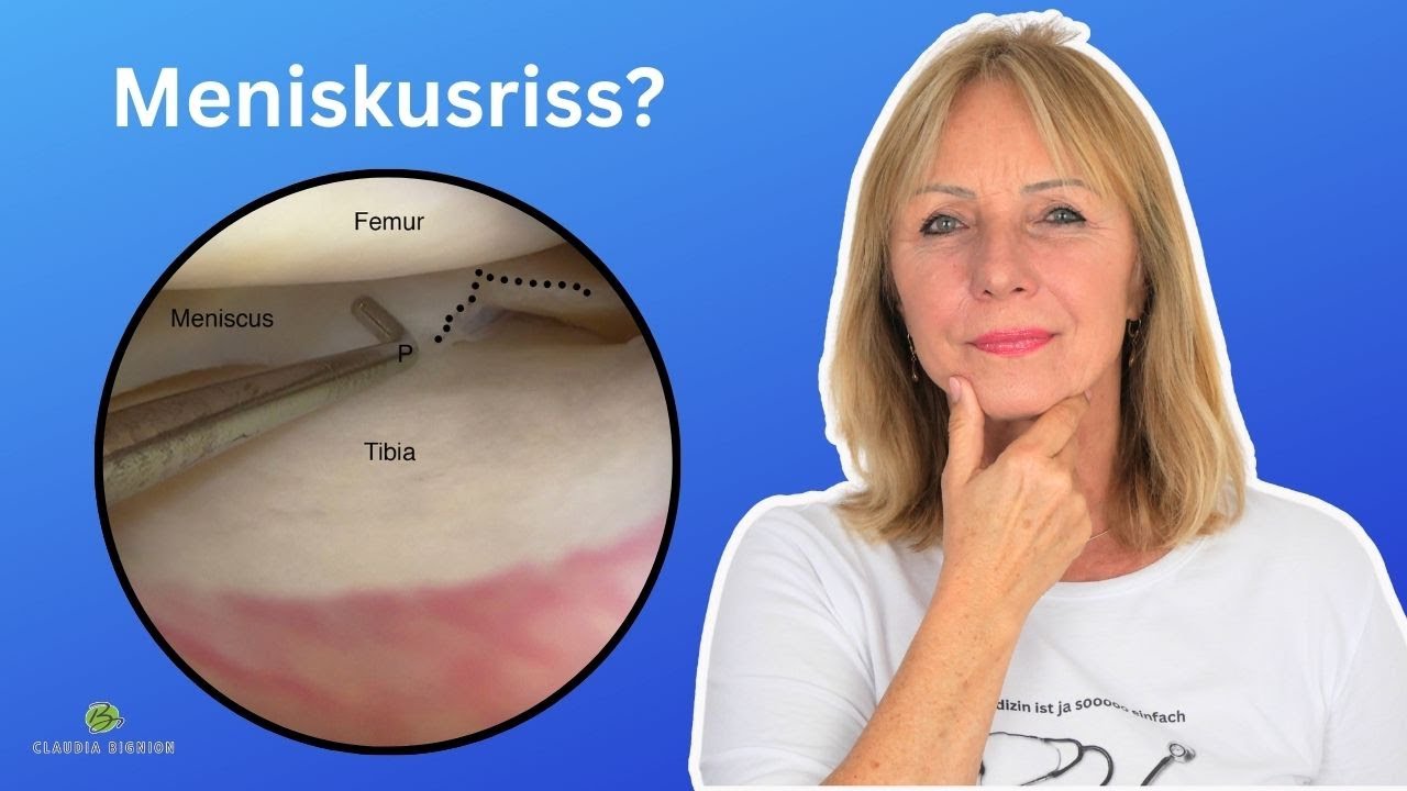 Knacken und Schmerzen in Knie. Vielleicht ein Meniskusriss? | Dr ...