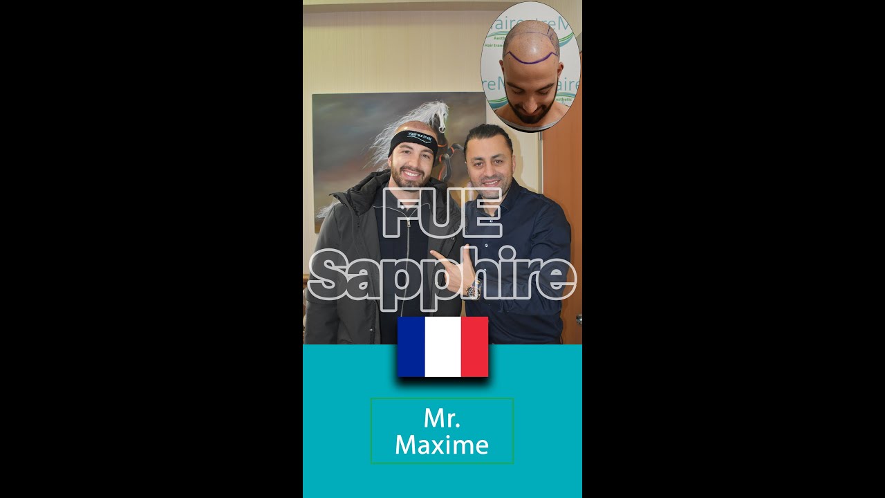Monsieur Maxime après l’opération 🇫🇷 - Méthode Fue Sapphire - Greffe de Cheveux en France - YouTube