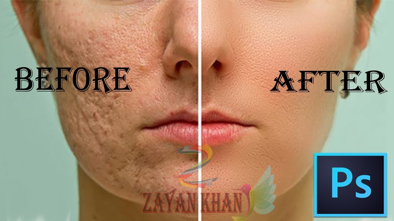 BEAUTIFUL RETOUCHING SKIN IN ADOBE PHOTOSHOP REMOVE BLEMISHES SCARES ...