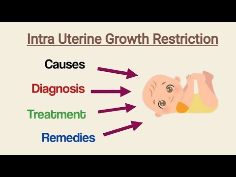 INTRA UTERINE GROWTH RESTRICTION | IUGR CAUSES DIAGNOSIS TREATMENT ...