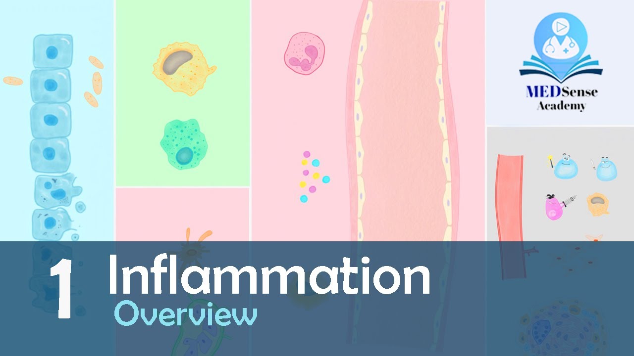 Inflammation Overview - YouTube