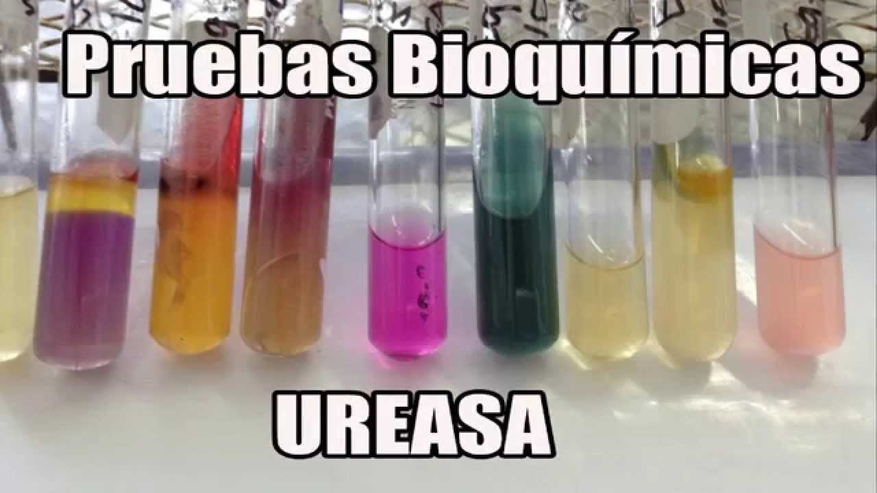 Salmonella Urease Test at Victor Vanhoy blog