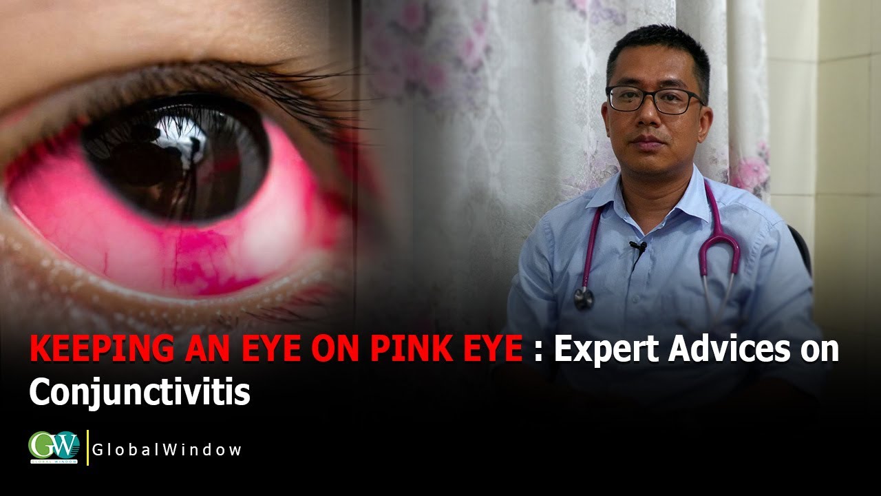 KEEPING AN EYE ON PINK EYE : EXPERT ADVICES ON CONJUNCTIVITIS - YouTube