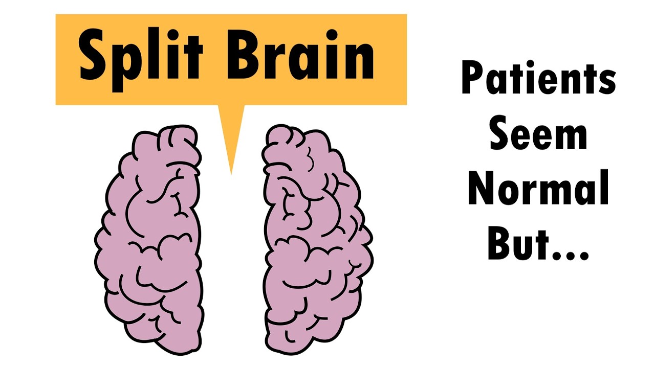 The Split Brain Experiment - & what it means for Free Will - YouTube