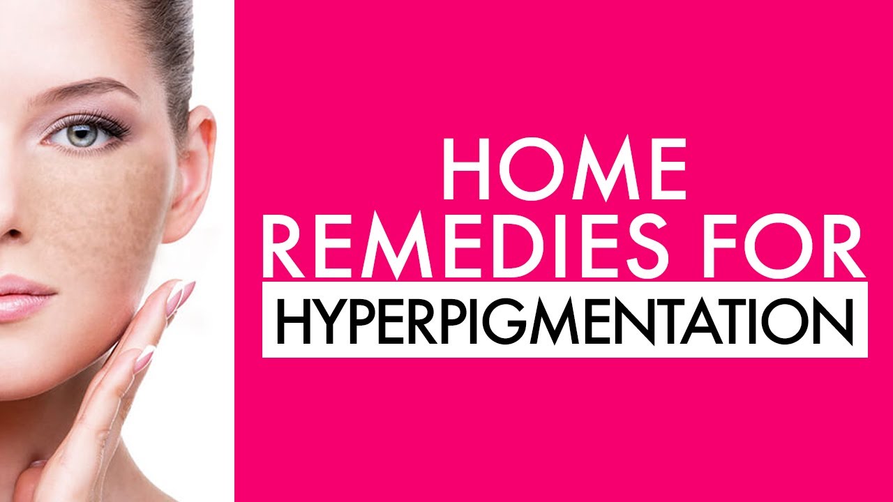 Home Remedies For Hyperpigmentation - YouTube