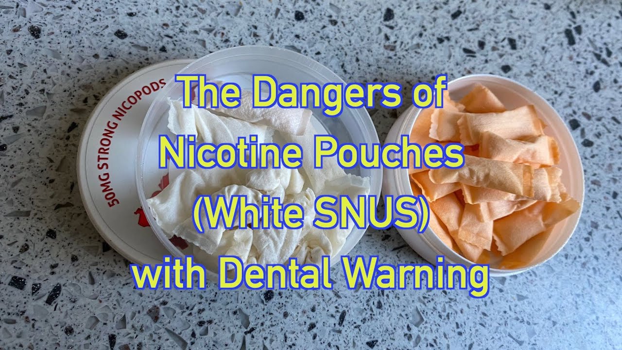 The Dangers of Nicotine Pouches (White SNUS) with Dental Warning - YouTube