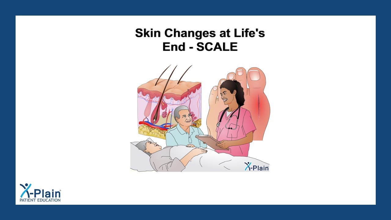 Skin Changes at Life's End - SCALE - YouTube