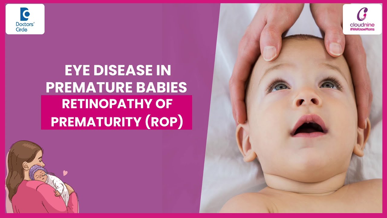 EYE DISEASE in Premature Baby-ROP-Dr.Vardhelli Venkateshwarlu at ...