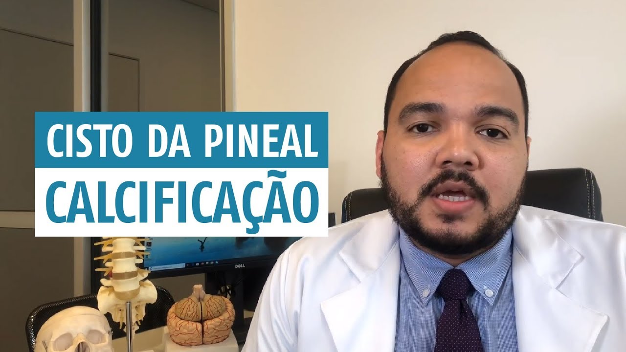 Cisto da pineal e calcificação da pineal: causas e tratamentos - YouTube