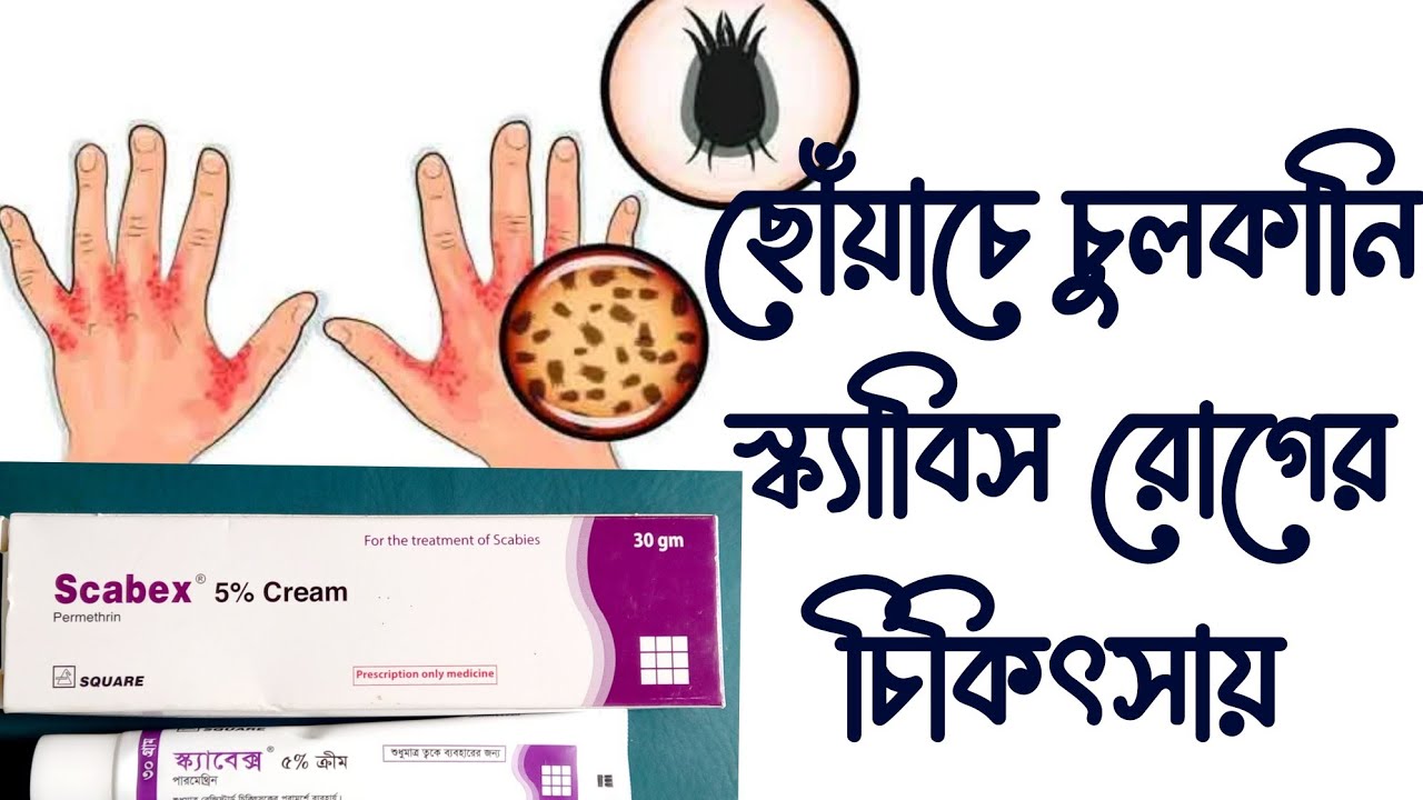 Scabex cream uses | খোস পাচড়া চুলকানি দূর করার ক্রিম - YouTube